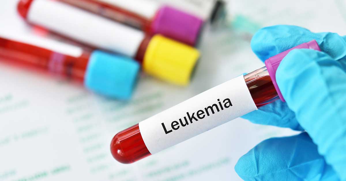 Leukemia - Summary, Symptoms & Treatments